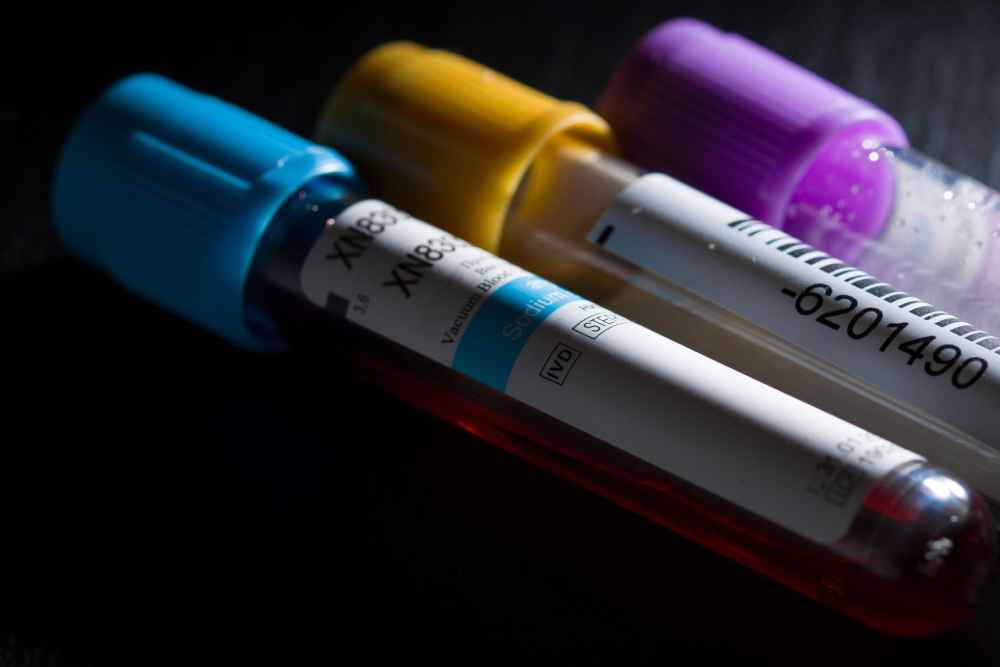 斯马特SD1生化分析仪对比迈瑞BS-480，哪个更胜一筹？